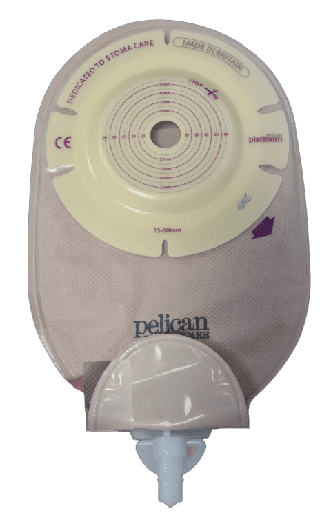 Urostomy | Ainsworth Surgical